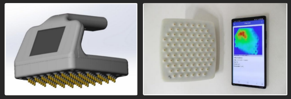 PORTABLE HOME DEVICE FOR EARLY DETECTION OF BREAST CANCER | 99.5 WLOV PORTABLE HOME DEVICE FOR EARLY DETECTION OF BREAST CANCER | 99.5 WLOV